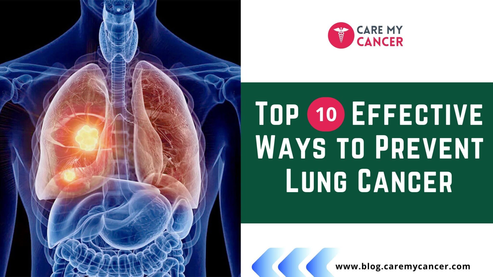 Top 10 Effective Ways to Prevent Lung Cancer Top 10 Effective Ways to Prevent Lung Cancer
