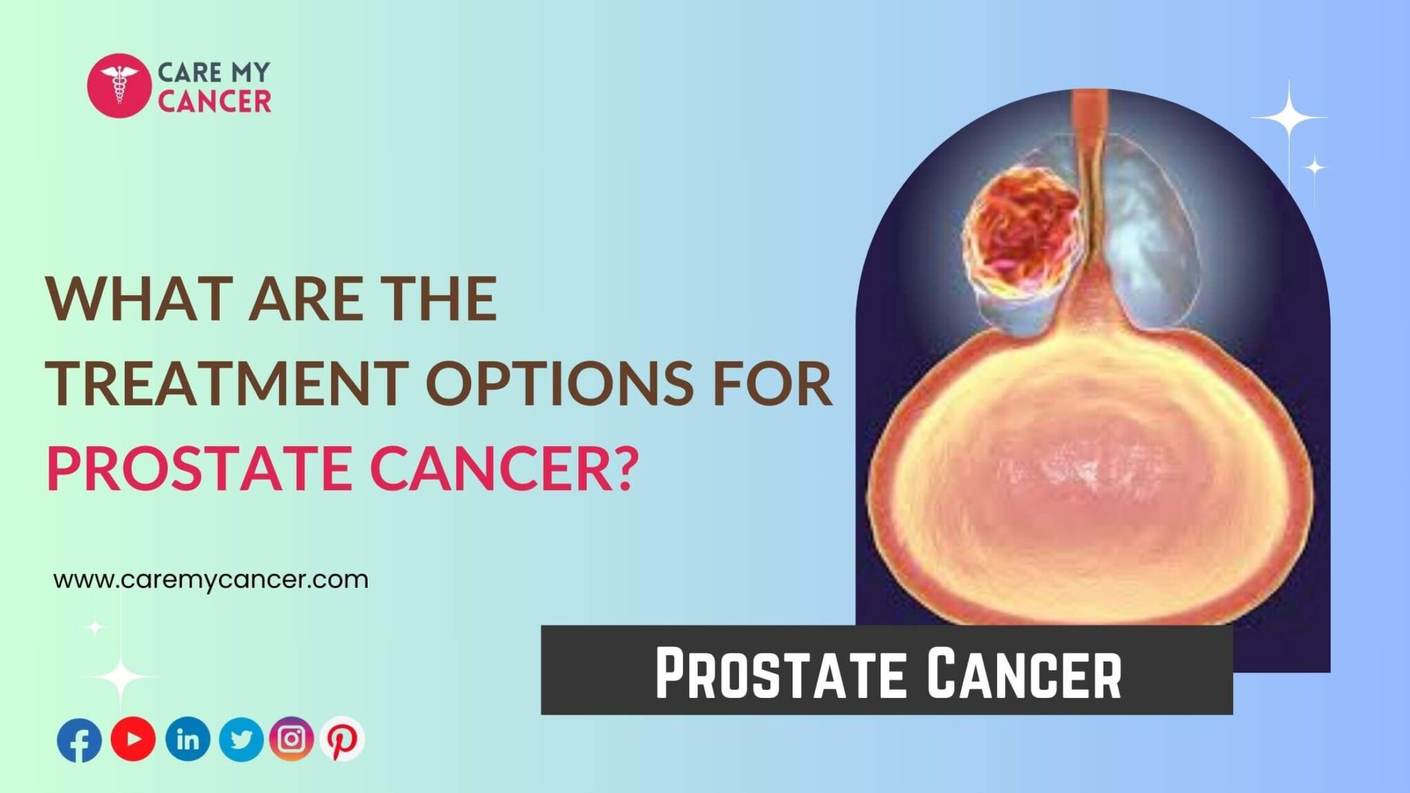 What Are the Treatment Options for Prostate Cancer?