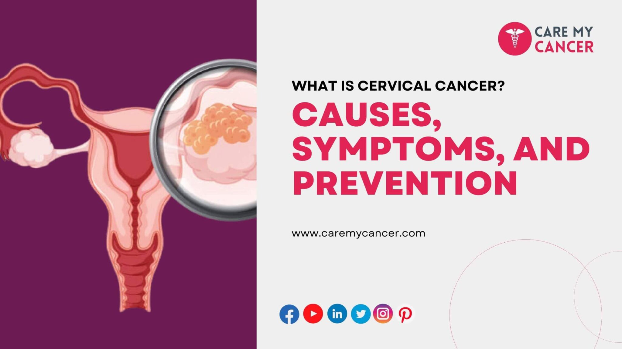 What is Cervical Cancer? Causes, Symptoms, and Prevention