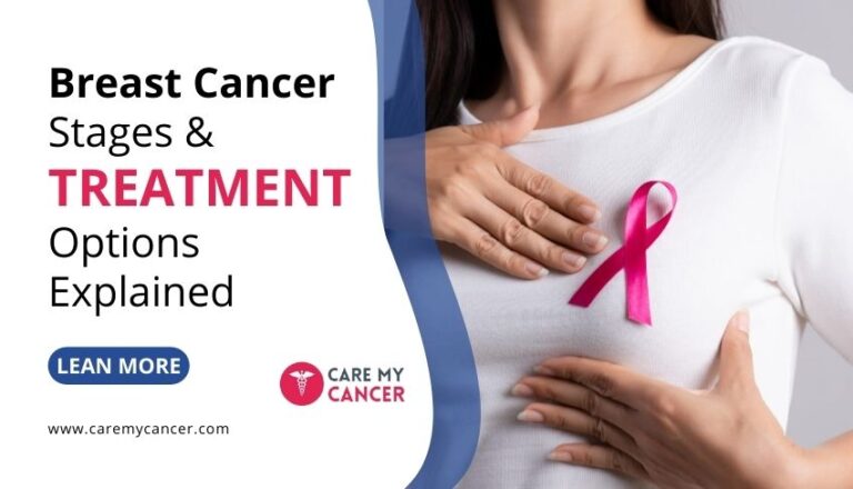 Breast Cancer Stages and Treatment Options Explained