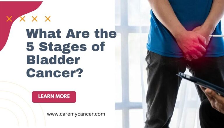 What Are the 5 Stages of Bladder Cancer? | A Complete Guide